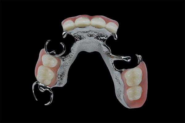 Quality Customizable Removable Dentures Titanium Framework Dental Metal Framework for sale