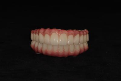 China Customize Hybrid Dental Implants Hybrid Denture With Titanium Bar for sale
