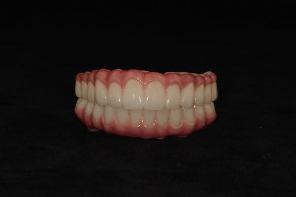 Quality Customize Hybrid Dental Implants Hybrid Denture With Titanium Bar for sale
