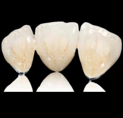China Customizable Semi Precious Crown Or Bridge Precious Alloy Crown And Bridge for sale