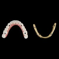 Quality Customize Hybrid Dental Implants Hybrid Denture With Titanium Bar for sale