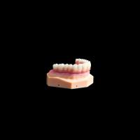 Quality ALL On X Implant Titanium Bridge Dental With Composite Accurate for sale