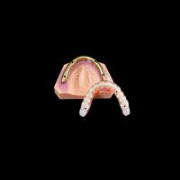 Quality Customizable Dental Zirconia Bridge Over Milled Implant Bar High Accuracy for sale