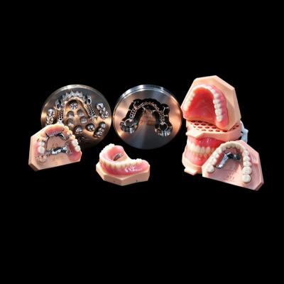 China Titanium Metal Framework Denture Removable False Teeth Custom for sale