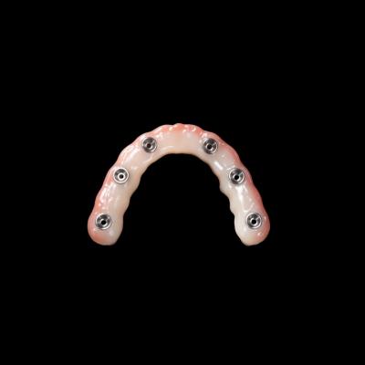 China Implanting Immediate Load Dentures Light Pink Removable Artificial Teeth for sale