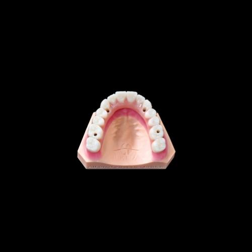Quality Implanting Immediate Load Dentures Light Pink Removable Artificial Teeth for sale