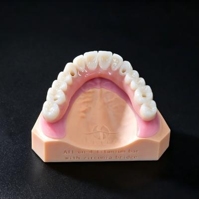 China ALL On  X Implant Zirconia Bridge Implant Crown Bridge Natural Appearance for sale
