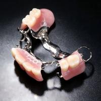 China Customizable Removable Dentures Titanium Framework Dental Metal Framework for sale