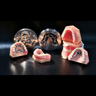 removable partial overdenture