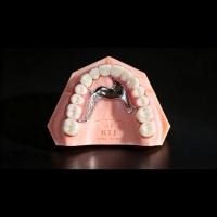 Quality High Strength Titanium Crown And Bridge Coping With Composite for sale