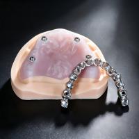 China All On X Implant Titanium Bridge for sale