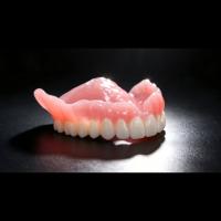 China Full Arch Overdenture Removable Prosthodontics for sale