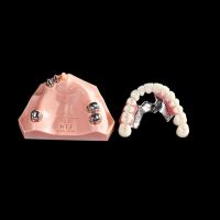China Telescope Removable Dentures Precision Attachment Overdenture Arylic for sale