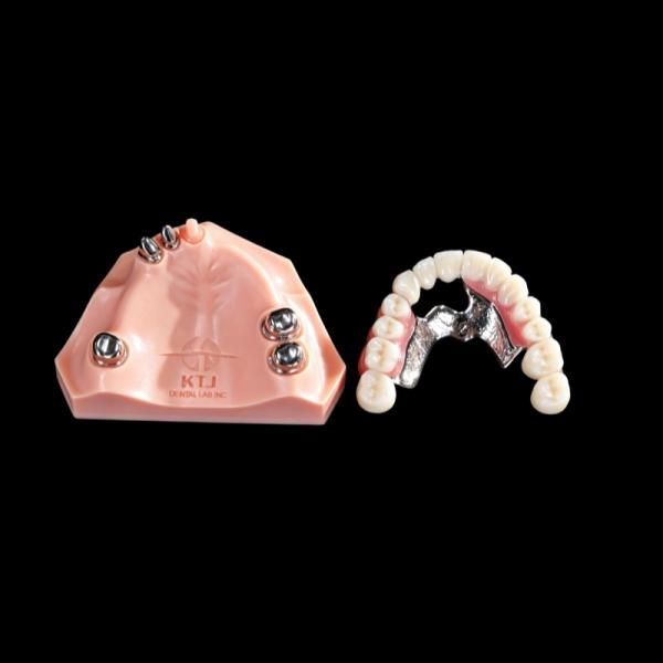 Quality Telescope Metal Crown And Bridge For Dental And Orthodontic for sale