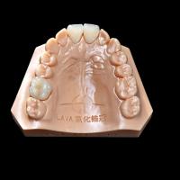China Lava Crown And Bridge High Accuracy for sale