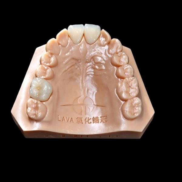 Quality Lava Crown And Bridge High Accuracy for sale