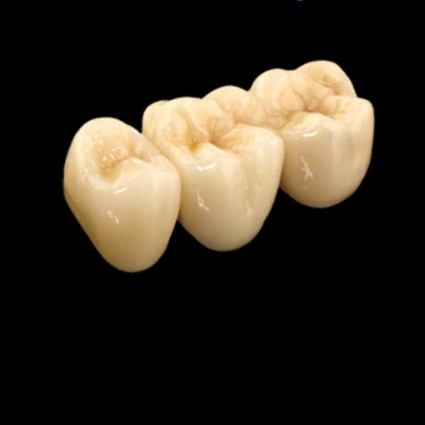 Quality Yellow Metal Crown And Bridge Precious Alloy Crown Bridge Customizable for sale