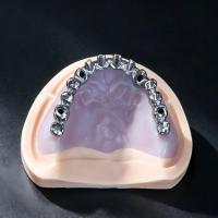 Quality ALL On X Implant Titanium Bridge Dental Only Framework Professional for sale