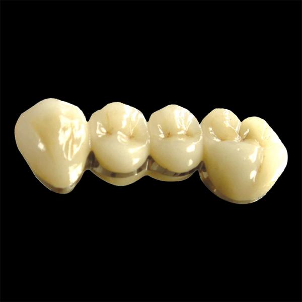 Quality Metallic / Natural Ti Base Crown Post Core Titanium Crowns For Teeth for sale