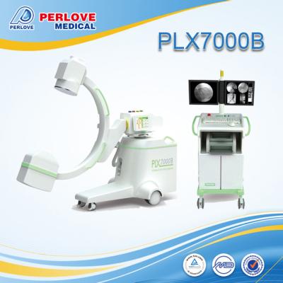 China Middle digital C arm system PLX7000B with DSI for sale