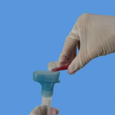 China Van de het Speekselsteekproef van DNA de Beschikbare Scheiding van het de Test Medische Speeksel Te koop