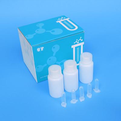 Κίνα 60mL μίας χρήσης αλυσωτή αντίδραση πολυμεράσεων εξαρτήσεων εξαγωγής DNA νουκλεϊνικού οξέος προερχόμενη από ιό προς πώληση