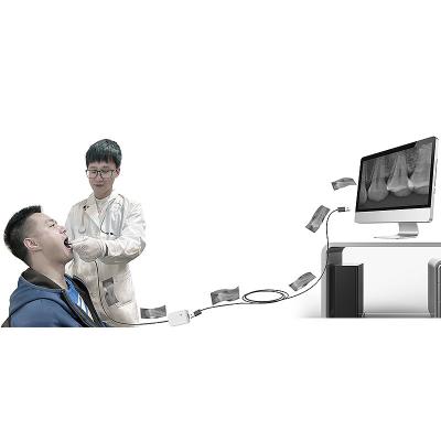 Cina Wireless HDR500A Dental Xray Sensor Rvg Digital X Ray Intraoral Sensor in vendita