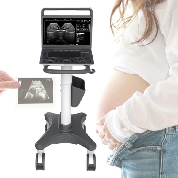 Quality MSK Ultrasound TDI CW Color Sonoscape E2 E3 & Sonoscape E1 Usg for sale