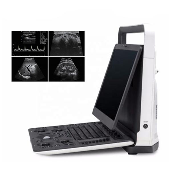 Quality MSK Ultrasound TDI CW Color Sonoscape E2 E3 & Sonoscape E1 Usg for sale