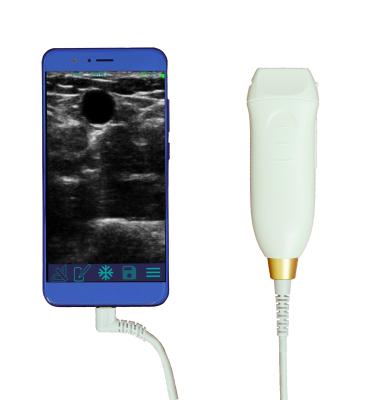 China Hot Sale Smart USB Convex Medical Doppler Ultrasound Scanner Ultrasound Probe for sale