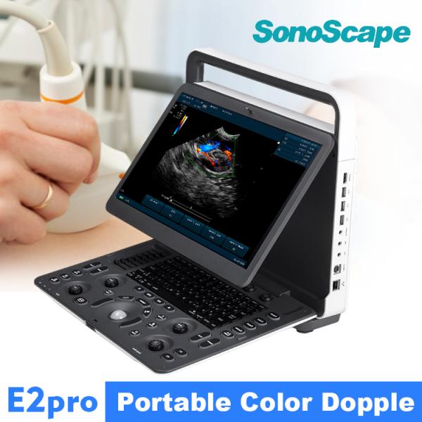 Quality SonoScape E2pro Color Doppler Echo Machine Ultrasound Machine USG with TDI CW PW for sale