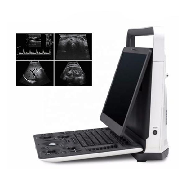 Quality SonoScape E2pro Color Doppler Echo Machine Ultrasound Machine USG with TDI CW PW for sale
