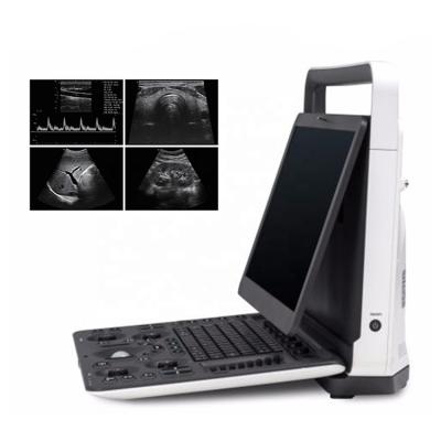 China High Quality Ultrasonic SonoScape E2 with Ultrasonic Sensors for sale