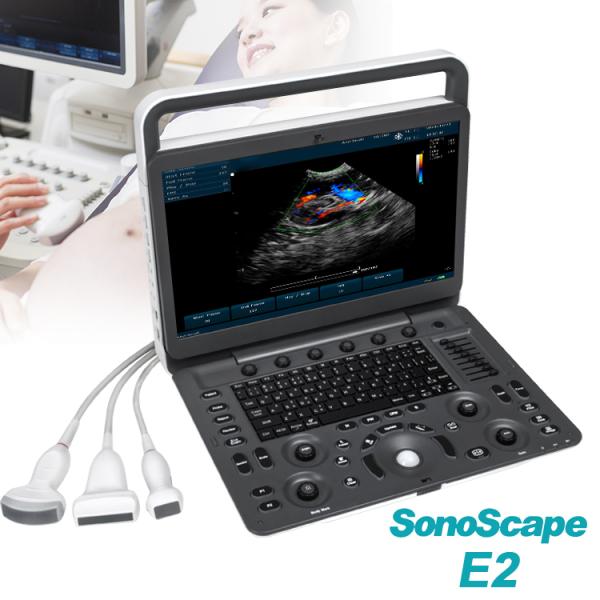 Quality High Quality Ultrasonic SonoScape E2 with Ultrasonic Sensors for sale