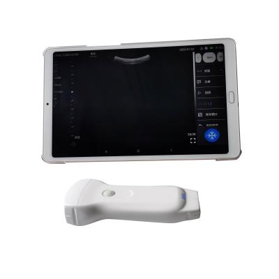 China Wireless Android/ios Usb Ultrasound Probe Dual Head Ultrasound Scanner 3 in 1 Convex Linear Phased Array Pocket Ultrasound for sale