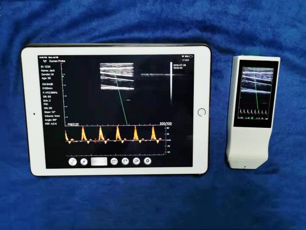 Quality Wireless Linear Probe High Frequency Probe Special Tool for Visual Puncture for sale