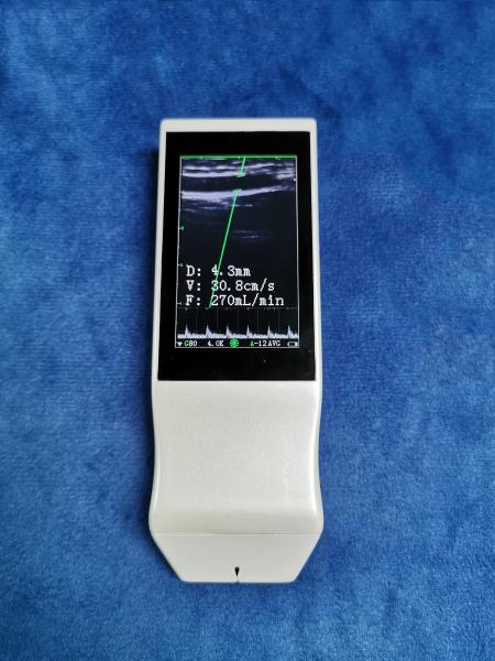 Quality Wireless Linear Probe High Frequency Probe Special Tool for Visual Puncture for sale