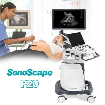 China Sonoscape Portable Color Doppler Ultrasound Sonoscape S22 Ultrasound Machine Sonoscape P20 Doppler Ultrasound for sale