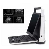 Quality Hot Slaes Ecografo Portatil Sonoscape E2 Ultrasonido Portatil for sale