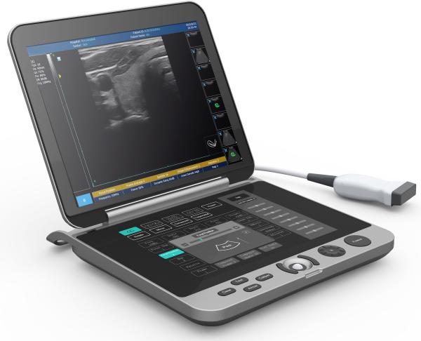 Quality High Resolution  Laptop B/W Ultrasound MSK  Ultrasound Scanner  Laptop Ultrasound Machine for sale