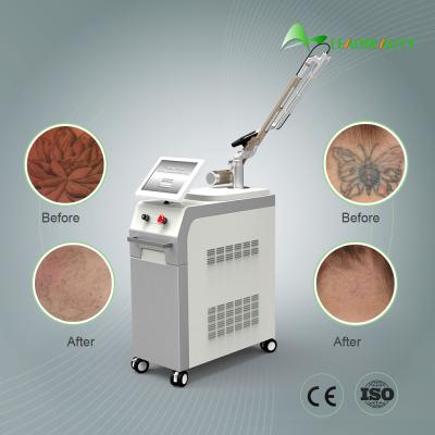 China Hot promotion!! 2018 newest laser removal tattoo/ q switched nd yag laser/laser tattoo removal machine price(CE/ISO/TUV) for sale