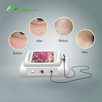 China New technology and best selling product spider vein home use.Let you free. for sale