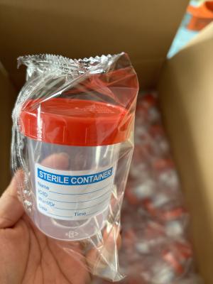 China Urine Collection Cup - Essential Hospital Sampling Consumables for Health Examination Centers for sale