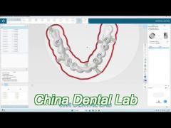 ivoclar digital dental crowns process noritake porcelain high accuracy