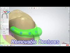 skelete chrome metal partial denture printed cocr denture design