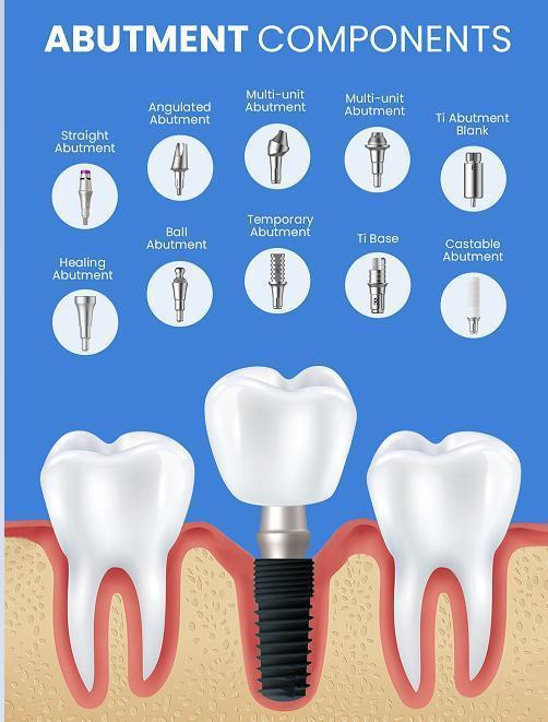 High Precise Titanium Abutment for Dental Implant Unit Screw 3 Good Price Dental Mini Implant Narrow Connection for Teeth Restoration