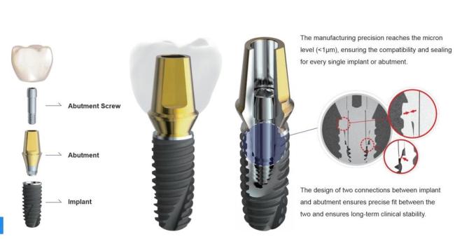 Best Quality Chines Dental Implant Abutment Screw Hexagon External Hot Selling Professional Dental Implant Lab Analog for Dental Clinical