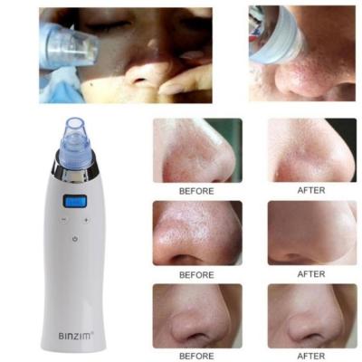 China Handheld pore cleaner Vacuum Blackhead Remover Vacuum Suction Tool Face Clean Facial Diamond Dermabrasion Machine for sale