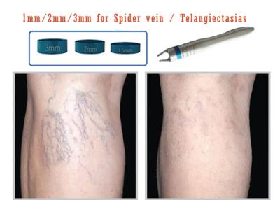 Cina a casa macchina di rimozione della vena del ragno 940nm una terapia laser indolore di 15 watt in vendita