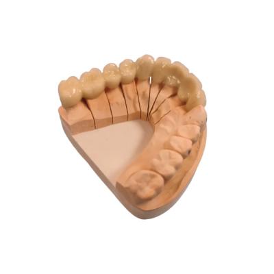 Китай Поверхность высокопрочной конюшни цвета кроны кроны PFM фарфора металла зубоврачебной ровная продается